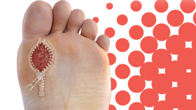 Foot and Ankle Surgery | OC Feet